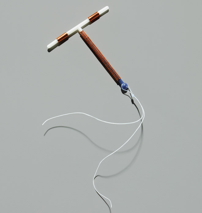 Copper IUD’s – The Bastidas Research Group Corrosion and Materials ...